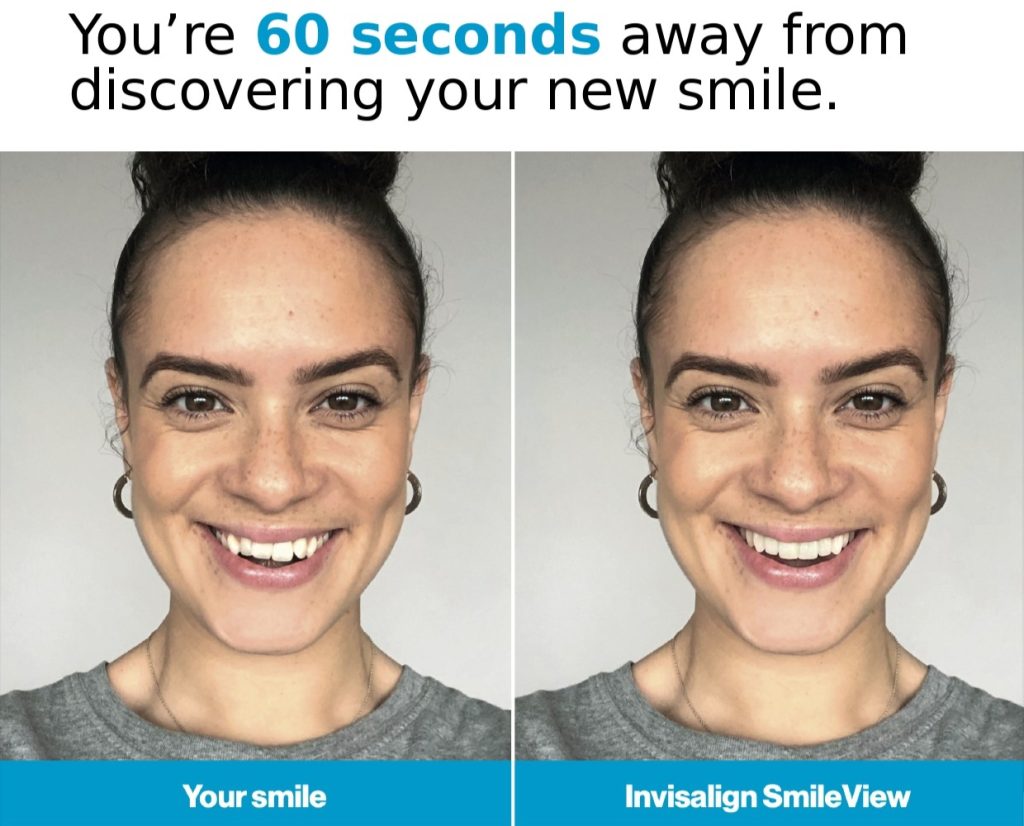 Invisalign - Orthodontist London